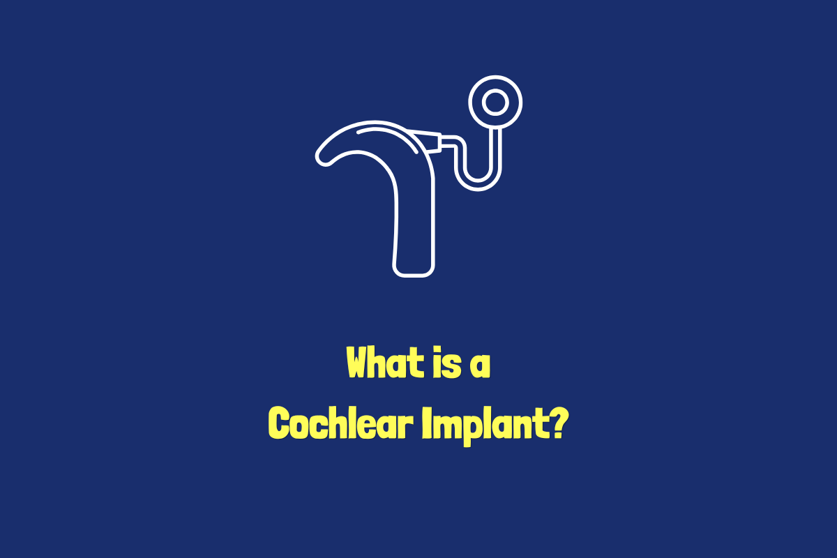 What is a Cochlear Implant? How It Works – Sound for Light